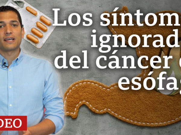 Cuáles son los síntomas del cáncer de esófago y por qué no debemos ...