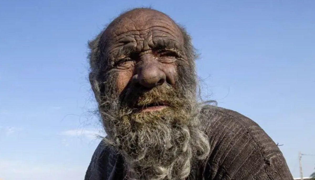 60 años sin bañarse: muere el hombre "más sucio del mundo" | 24horas
