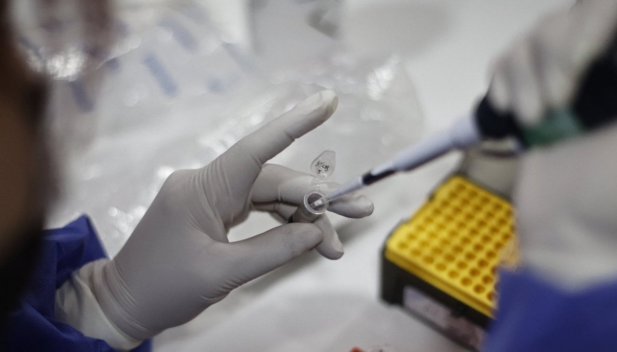 Viruela del mono: Minsal confirma primer muerto en Chile | 24horas