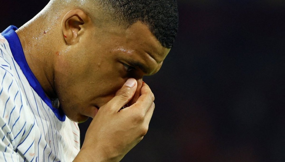 Así quedó la nariz de Kylian Mbappé tras choque en victoria de Francia ...
