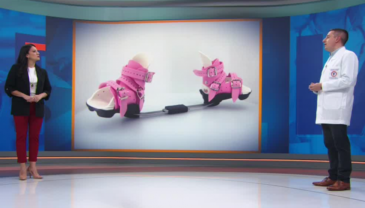 El Especialista responde: ¿Qué es el Pie Bot, zambo o equinovaro? | 24horas