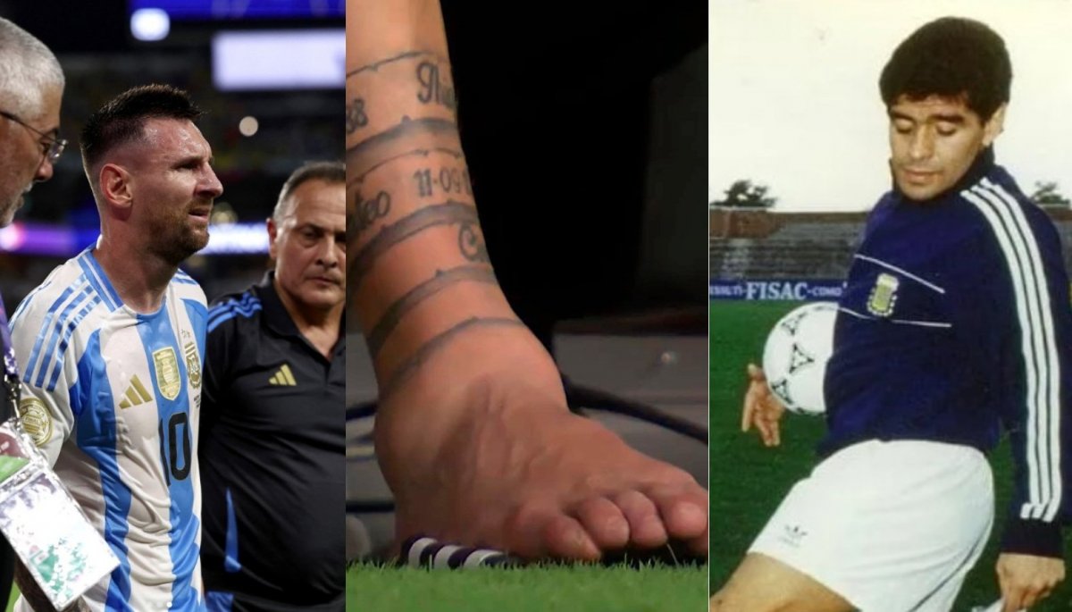La comparación de los tobillos lesionados de Messi y Maradona que ...